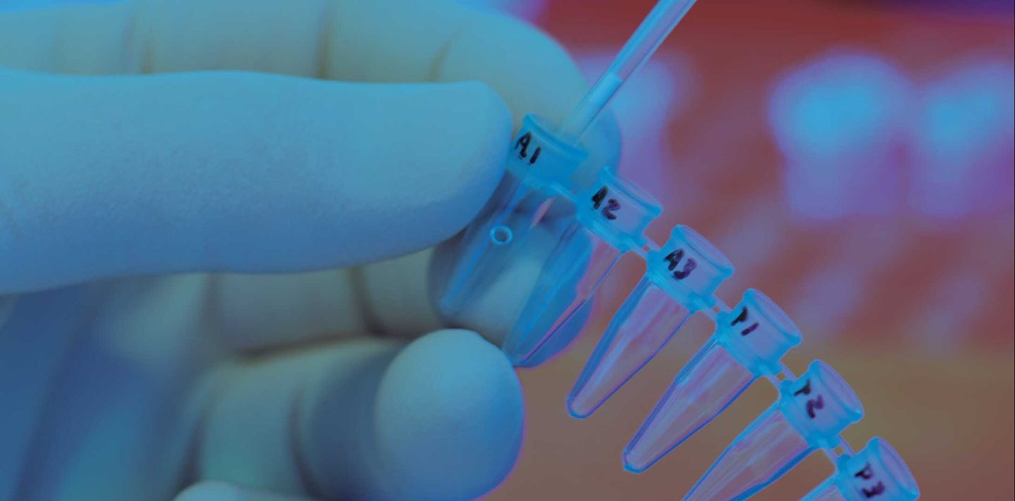 Whole Genome Sequencing